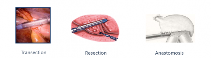 Cayman Curved Endoscopic EMDO GIA Articulating Reload